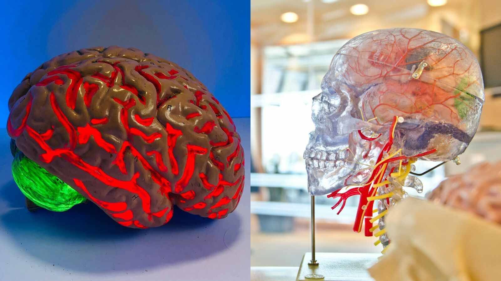 जीते जी मौत के समान है ये स्थिति, जानें सीनियर न्यूरोलजिस्ट ने क्या कहा ...