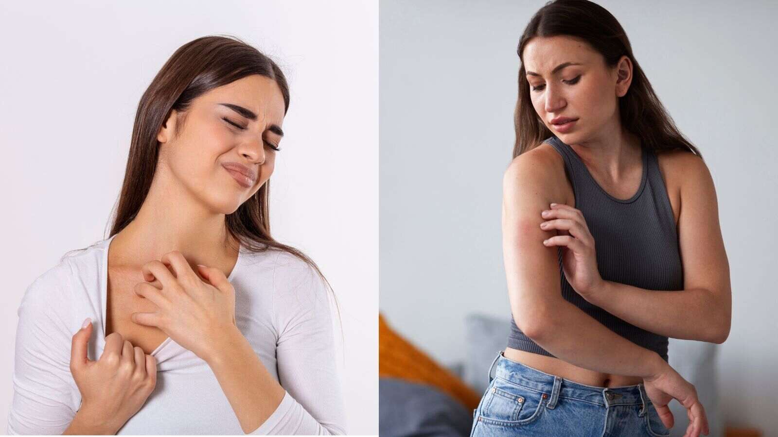 इस मौसम में बहुत आम है स्किन से जुड़ी ये समस्या, ऐसे होगा बचाव | skin itching rashes dryness and ...