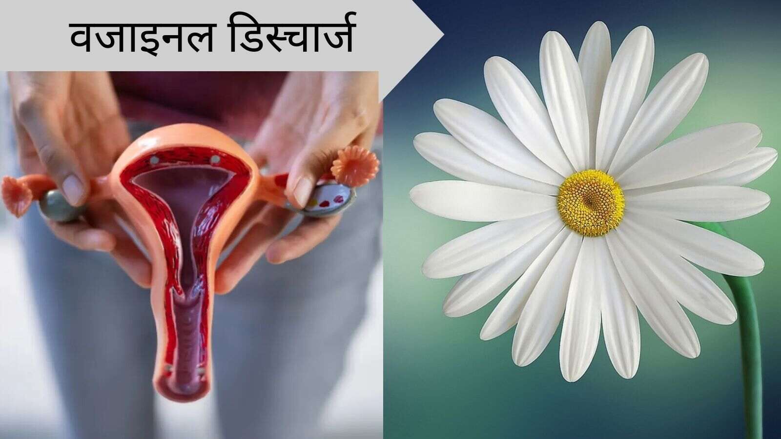 वो गीलापन असहज कर देता है...जानें वाइट डिस्चार्ज से जुड़ी जरूरी बातें ...