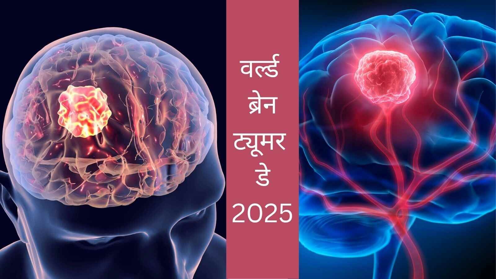 वर्ल्ड ब्रेन ट्यूमर डे: डॉक्टर बत्रा ने बताए हेल्दी ब्रेन के सीक्रेट्स ...